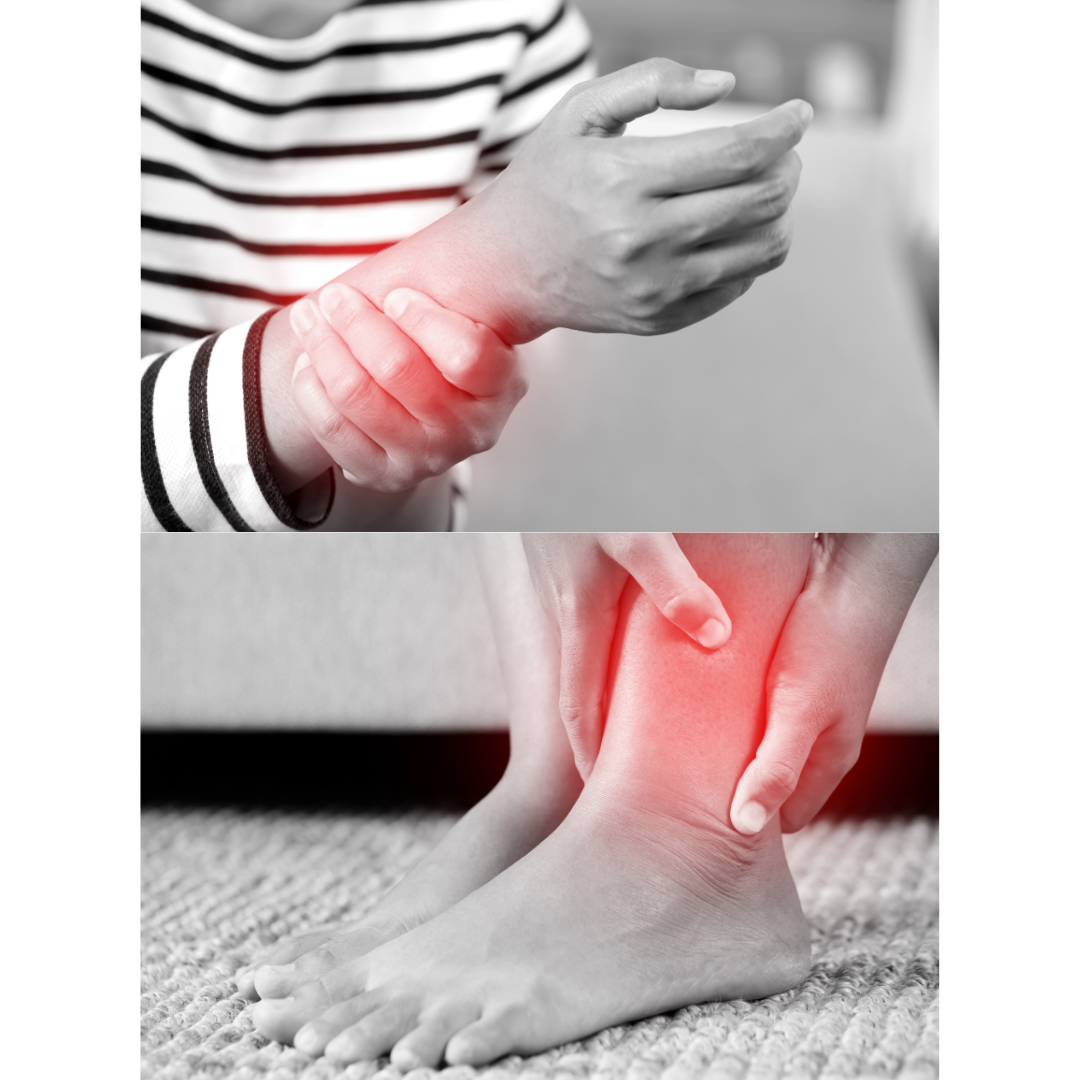 Minor Injuries | DREEAM